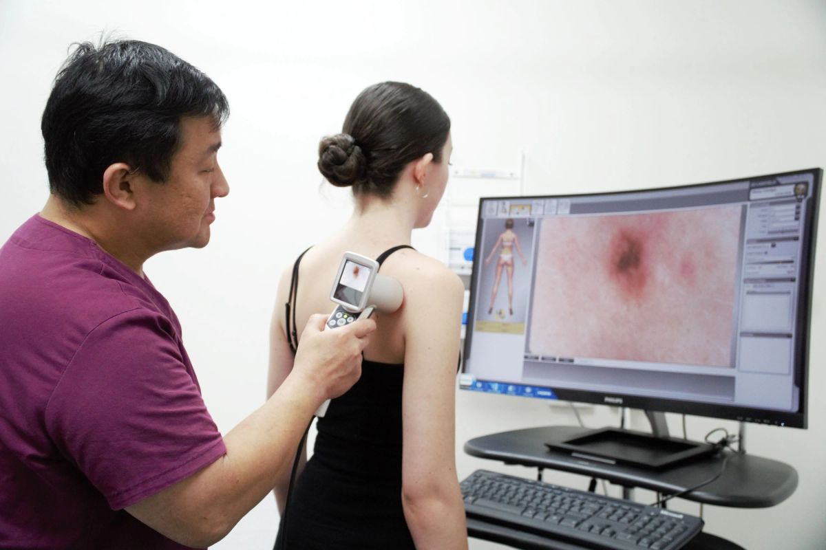 Mole Maping Skin Cancer Clinic NSW | Bulk Billing Available